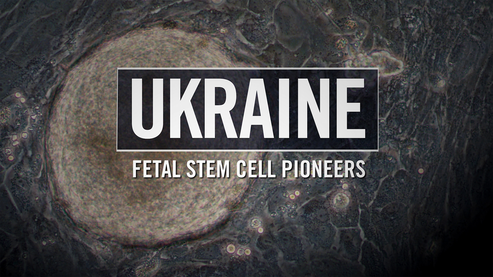 Ukraine: Fetal Stem Cell Pioneers (pre-release preview) - Ukraine ...